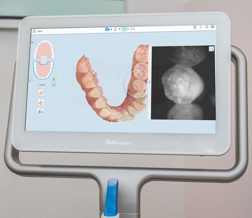 Pediatric Dentistry Los Angeles CA, Pediatric Dentist